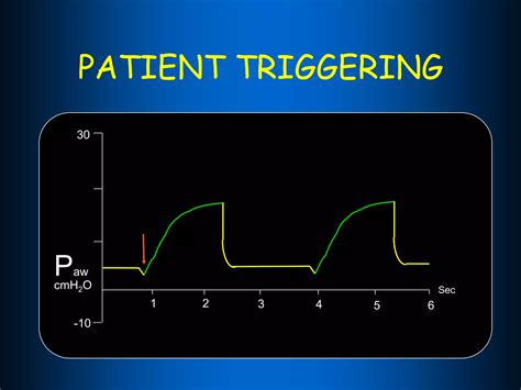 Ventilator Waveforms Dr Sanjay Chugh Pptx Lung And Respiratory Health Diseases And Conditions