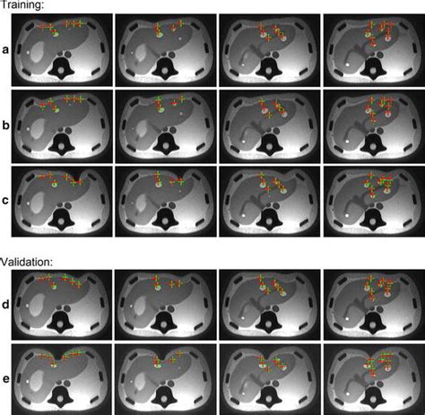 Parameters Estimation And Validation Of Personalized Heterogeneous