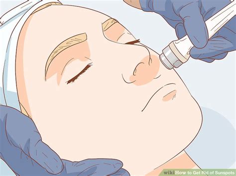 4 Simple Ways To Get Rid Of Sunspots Wikihow