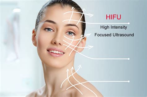 What Is The Principle Of HIFU Ultrasound Machine For Relieving Aging