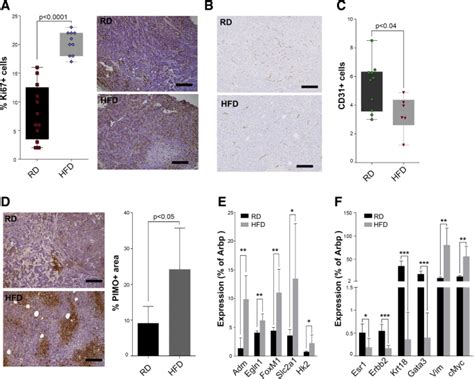 Obesity Promotes The Expansion Of Metastasis Initiating Cells In Breast
