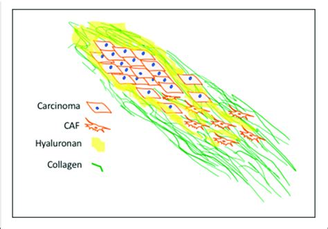 Progression Associated Fibrosis In Cancerized Stroma Deregulated