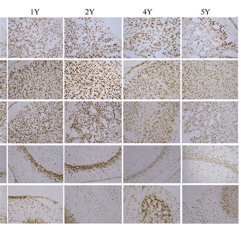 Expression Patterns Of Tet Genes In Tree Shrew Brains During Postnatal Download Scientific