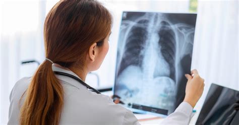 What Are The Effects Of Secondary Car Crash Injuries