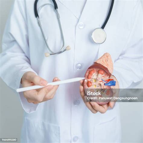 해부학적 신장 부신 모델을 들고 있는 의사 비뇨기계 및 결석의 질병 암 세계 신장의 날 만성 신장 비뇨기과 신장염 신장 및 이식