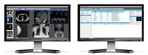 Sante Dicom Editor Santesoft Ltd