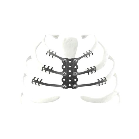 Durable Osteosarcoma Resection Reconstruction Rib Prosthesis Sale Or