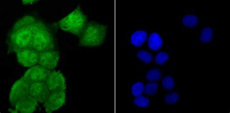Usp13 Rabbit Mab Sab Signalway Antibody