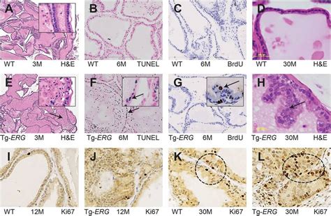 Morphological And Histological Differences In The Ventral Prostates Of