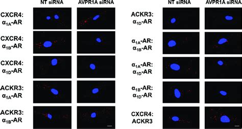 Detection of heteromers between α A B D ARs CXCR and ACKR upon Download Scientific