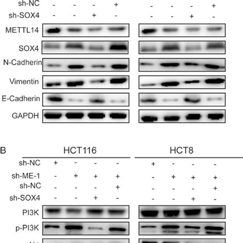 Mettl14 Expression Is Downregulated And Is Associated With Prognosis In