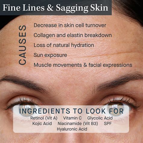 Sandra Lee Md Faad Faacs Its Never Too Early To Start Thinking