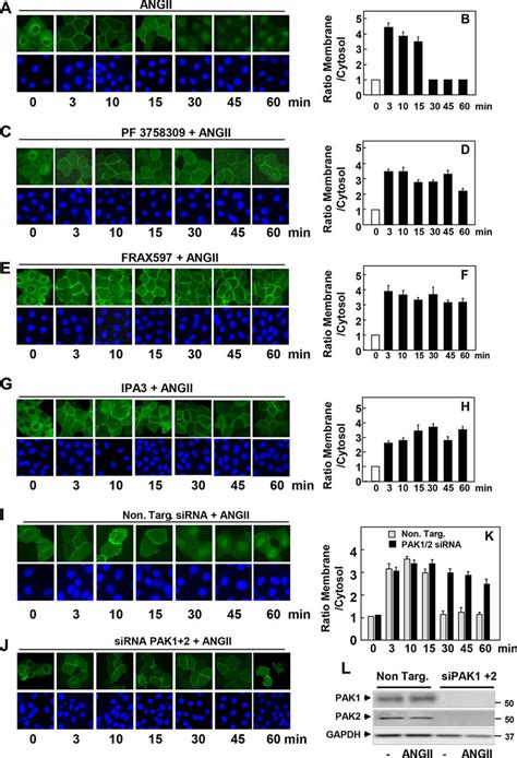 Inducible Egfp Pkd1 Remains Associated To The Plasma Membrane In The