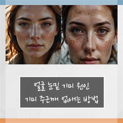 얼굴 눈밑 기미 원인 및 기미 주근깨 없애는 방법 네이버 블로그