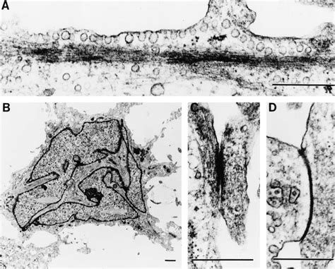 A Transmission Electron Micrograph Of A Cultured Lumen Intestinal