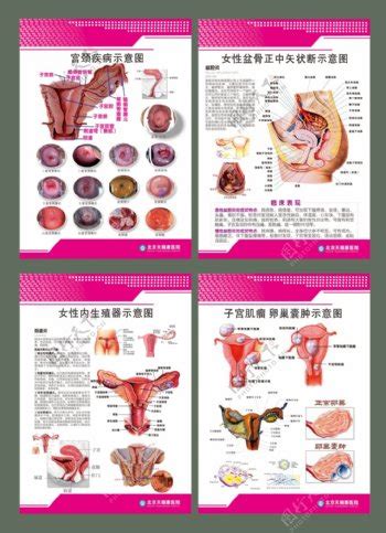 女性生殖系统图片素材 编号 图行天下