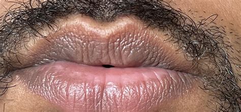 Please Help Me To Identify If Its My Segmental Or Non Segmental R