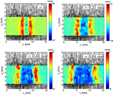 Shear Wave Sh Mode Propagation Along The Flexor Digiti Minimi Muscle Download Scientific