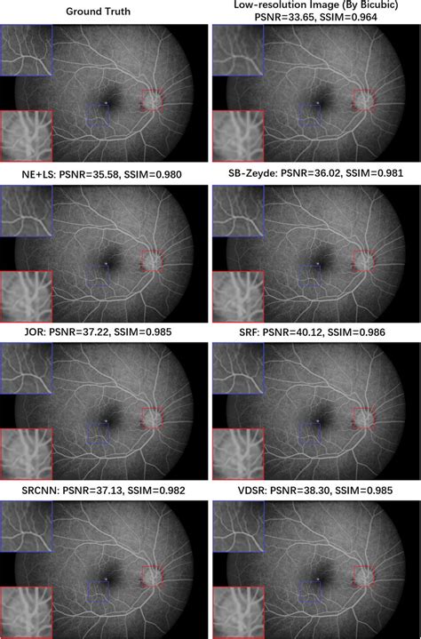 the reconstructed ffa images by different sisr algorithms under the