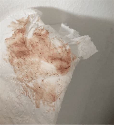 O Que é A Nidação Fetalmed Medicina Fetal Curitiba