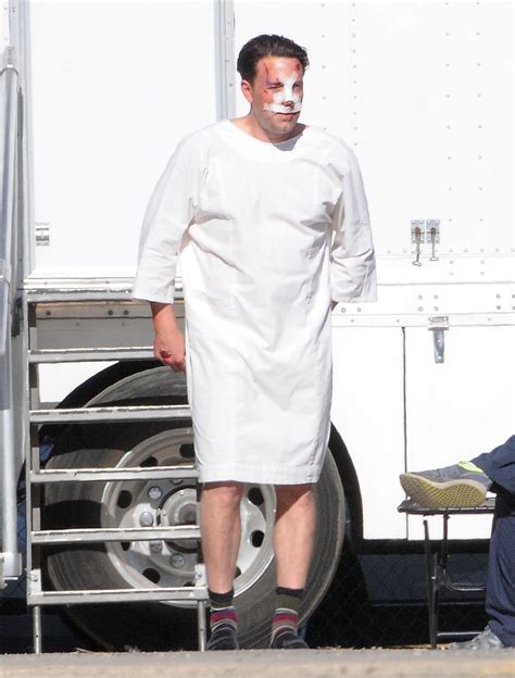 Ben Affleck Fuels Plastic Surgery Rumors