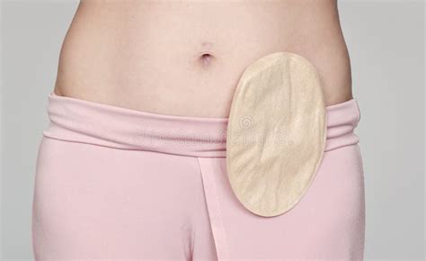 Colostomy Pouch Attached To Patient Image Stock Image Image Of