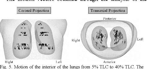 Figure 1 From Development Of A Dynamic Model For The Lung Lobes And