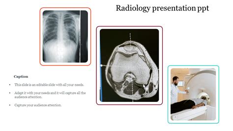 X Ray Ppt X Ray Powerpoint Presentation And Slides Ppt Presentation