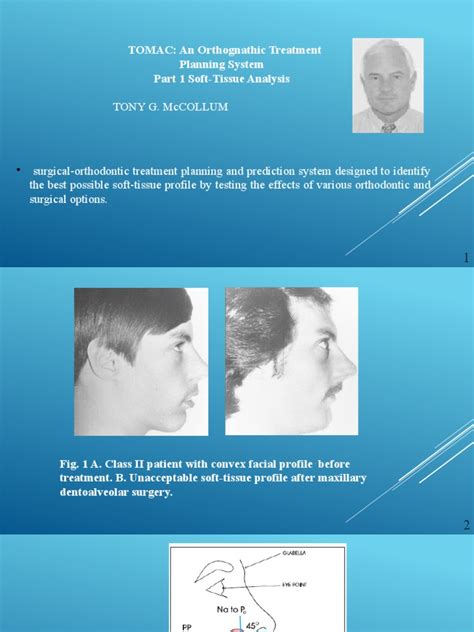 Tomac An Orthognathic Treatment Planning System Part 1 Soft Tissue
