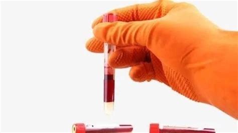 如何从血液化验上分辨出，到底是：细菌感染，还是病毒感染 知乎