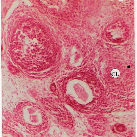 Cross Sections Of The Ovary Of Control Rat Showing Normal Download