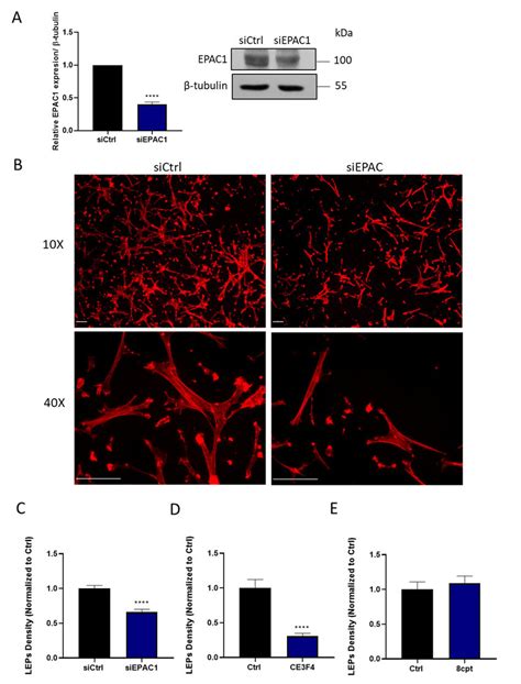 Epac1 Silencing Or Inhibition Decreases Leading Edge Protrusion Lep