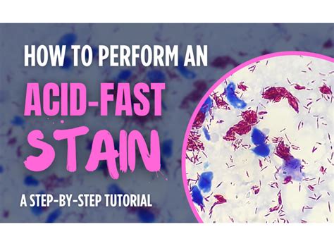 How To Perform An Acid Fast Stain