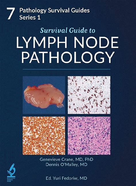 Survival Guide To Lymph Node Pathology Genevieve M Crane Md Phd