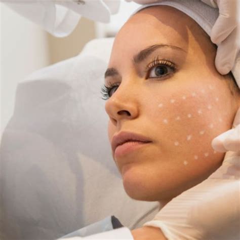 Rejuvenecimiento Facial Mesoterapia Clinica Jamelia