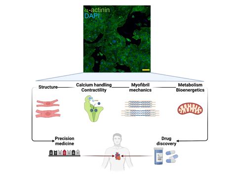 Cardiometabolic Diseases Model