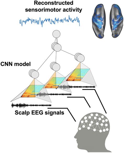 Human Brain Mapping Neuroimaging Journal Wiley Online Library