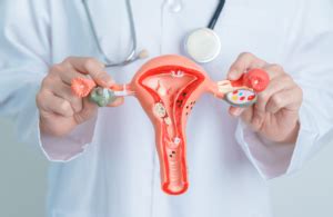 Endometriose vs adenomiose entenda as diferenças para um diagnóstico