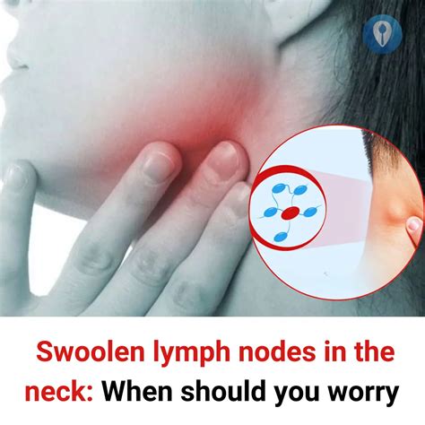 How To Identify Benign And Malignant Lymph Nodes