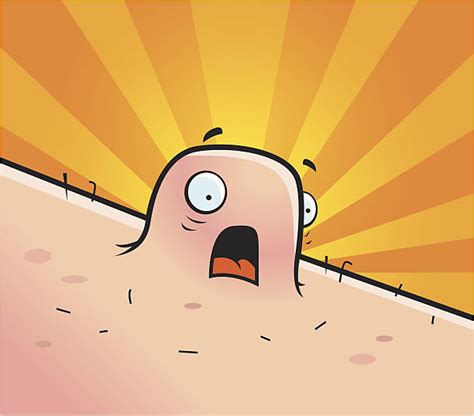 Pimple Illustrations Royalty Free Vector Graphics And Clip Art Istock