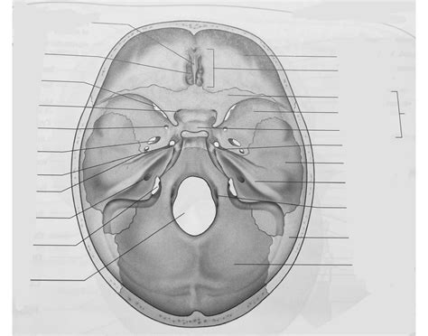 Superior View Of Floor Of Cranial Cavity Bandw — Printable Worksheet