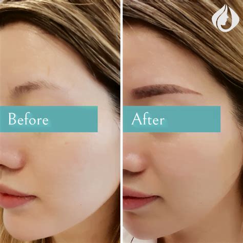 Microblading Microshading Toronto And North York La Vitalité Med Spa