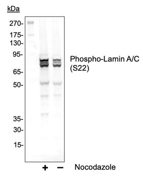 Phospho Lamin Ac Ser22 Recombinant Monoclonal Antibody Laminacs22
