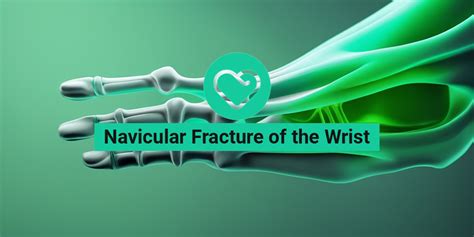 Navicular Fracture Of The Wrist Causes Symptoms And Treatment Options • Yesil Health Ai