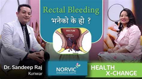 Ep 42 Rectal Bleeding भनेको के हो Dr Sandeep Raj Kunwar Norvic
