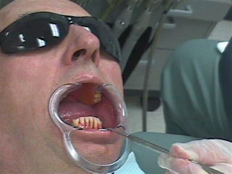 Periodonticendodontic Case Dr Galil Clinical Cases