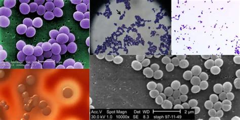 Staphylococcus Aureus Biology Notes Online