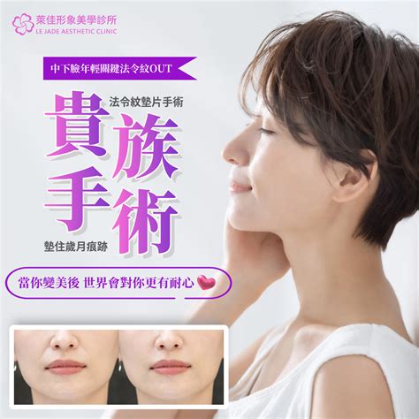 萊佳形象美學診所 台北店 深邃的 法令紋 總是會讓人顯老無比😖 若您試過電音波成效不太明顯