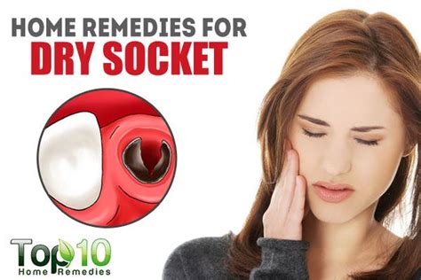 Home Remedies For Dry Socket Top 10 Home Remedies