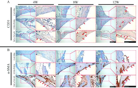 Immunohistochemical Analysis Of A Cd31 And B α Sma Red Arrow